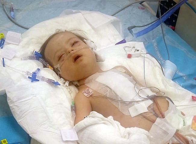 Coming above ground again