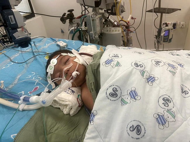 Waiting for transformation