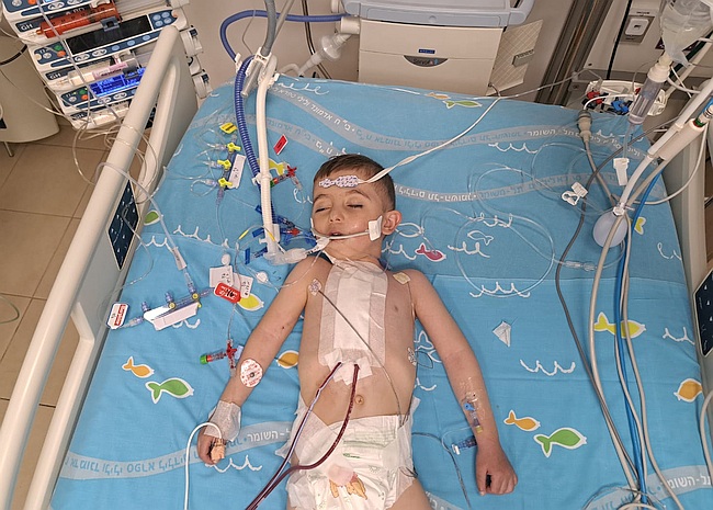 Waiting for transformation